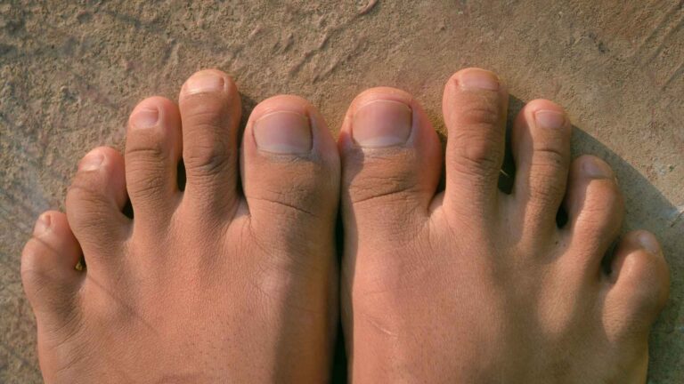 145 Toe Puns: Fun & Punny Toe Jokes