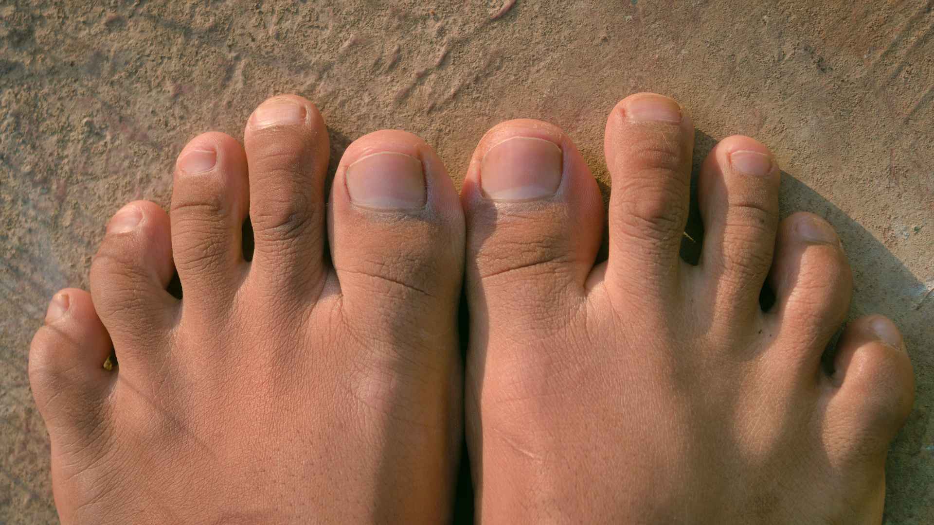 145 Toe Puns: Fun & Punny Toe Jokes